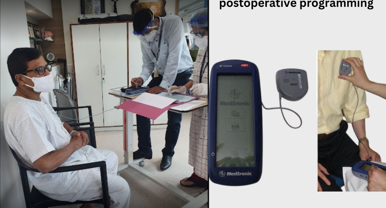 Components Of DBS System